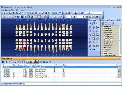| Dentalcompare Product Review Dentrix Is Great | Dentalcompare: Top ...