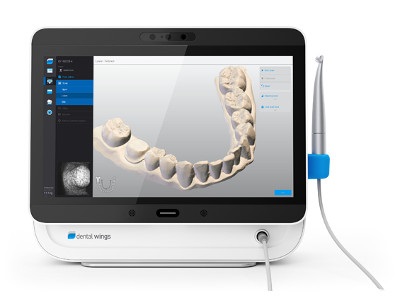 New Dental Product: Portable Intraoral Scanner from Dental Wings ...