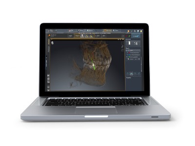 New Dental Product: SICAT Endo 3D Software from Dentsply Sirona ...