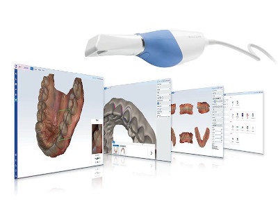 Planmeca Introduces the Planmeca Romexis® CAD/CAM Module | Dental News