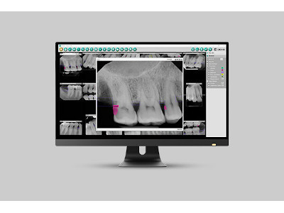 New Dental Product: DEXIS 10 Imaging Suite Software From DEXIS | Dental ...