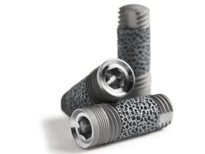 Spline Twist Dental Implant System from Zimmer Biomet | Dentalcompare ...